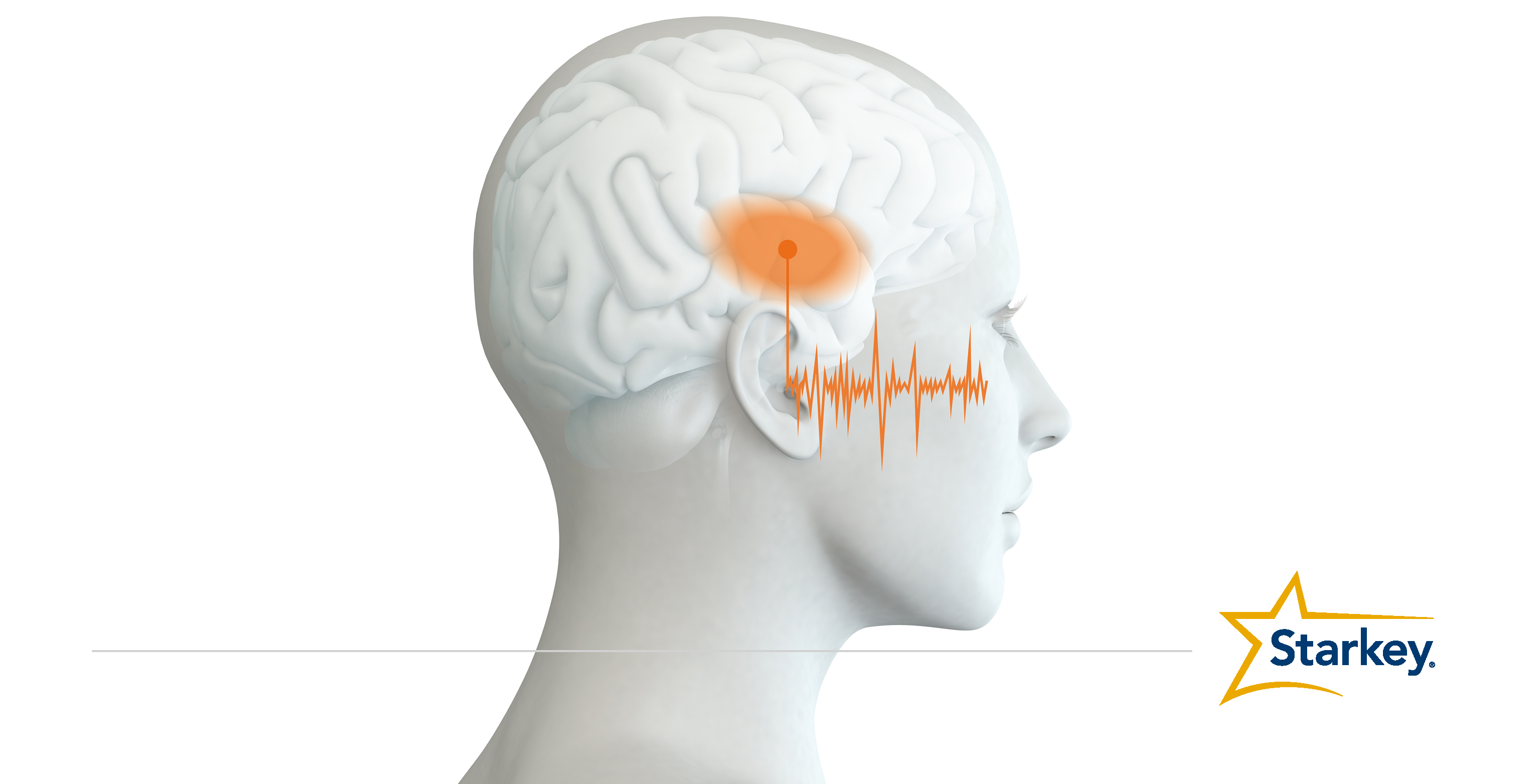 Unfortunate and Unpredictable Results of Untreated Hearing Loss